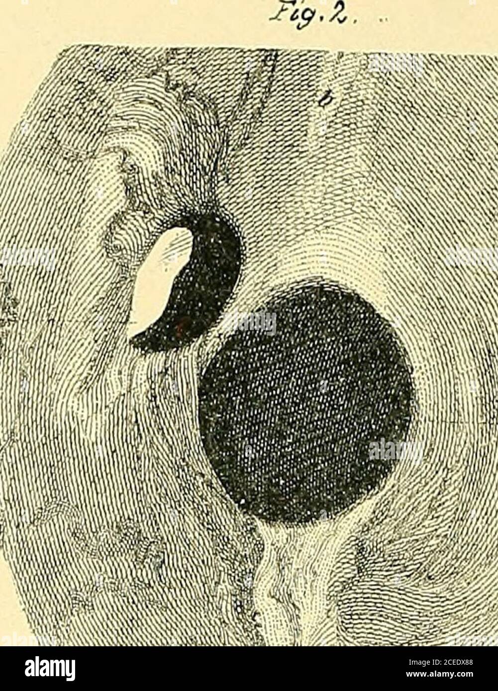 . The anatomy and surgical treatment of hernia. vi Hi. m Stock Photo ...
