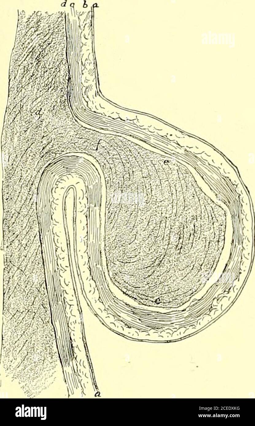 . The anatomy and surgical treatment of hernia. margin of the ring. The ...