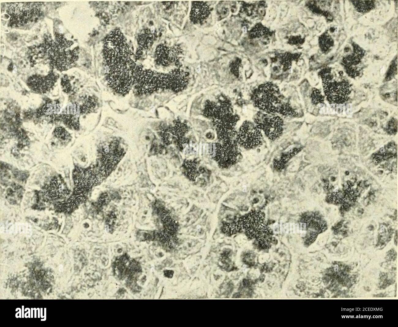 Zymogen hi-res stock photography and images - Alamy