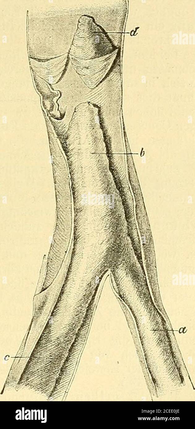 Anatomie der arterien hi-res stock photography and images - Alamy