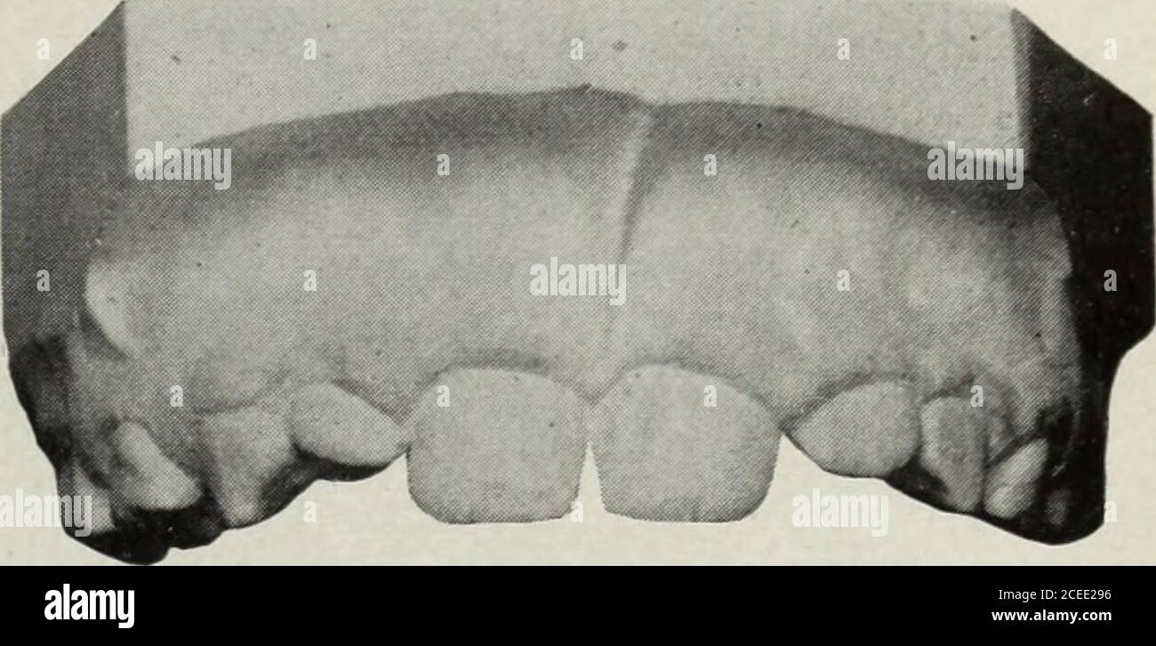 . The Dental cosmos. of the nasal passages and the surroundingbony ...