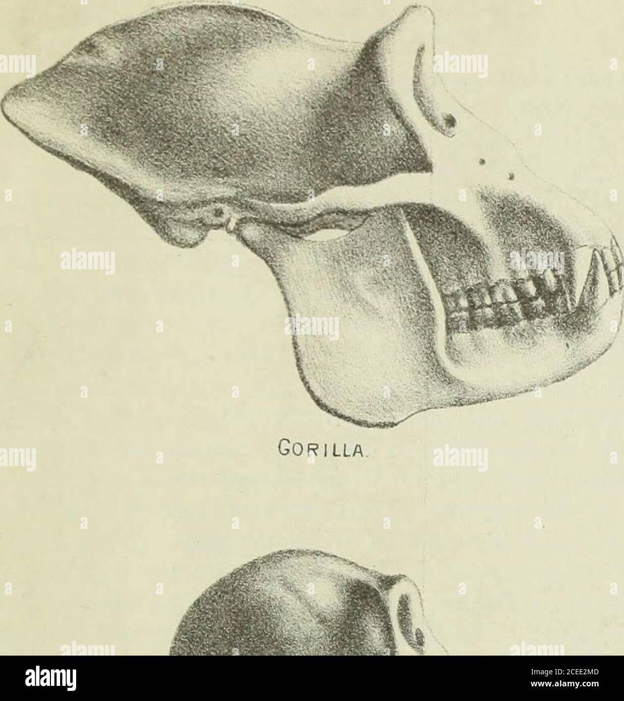 Alveolar bones hi-res stock photography and images - Alamy