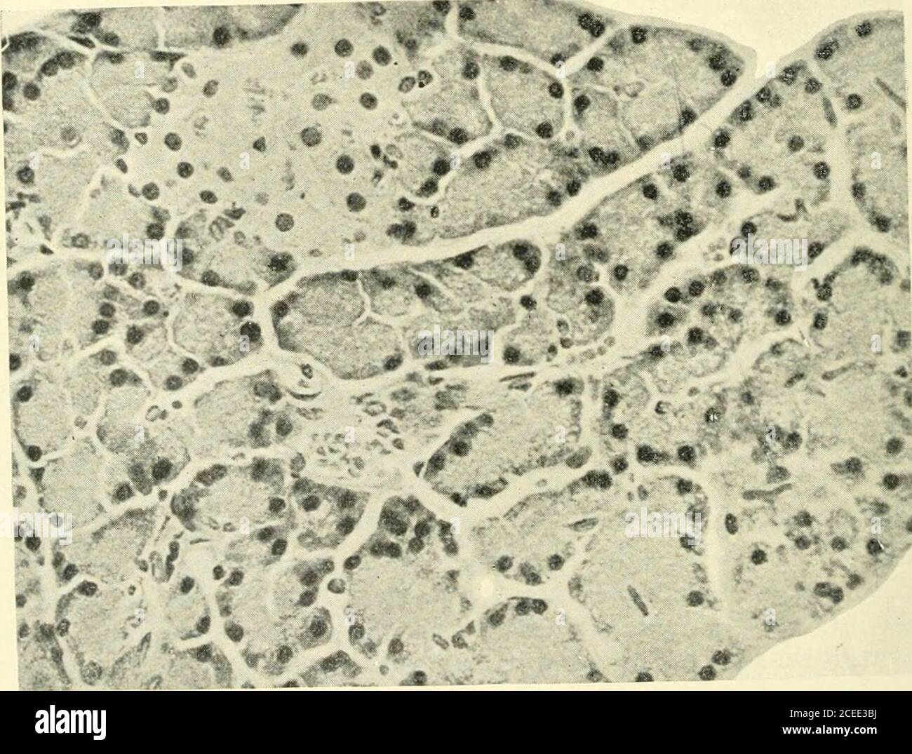 Alveolar Cells High Resolution Stock Photography and Images - Alamy
