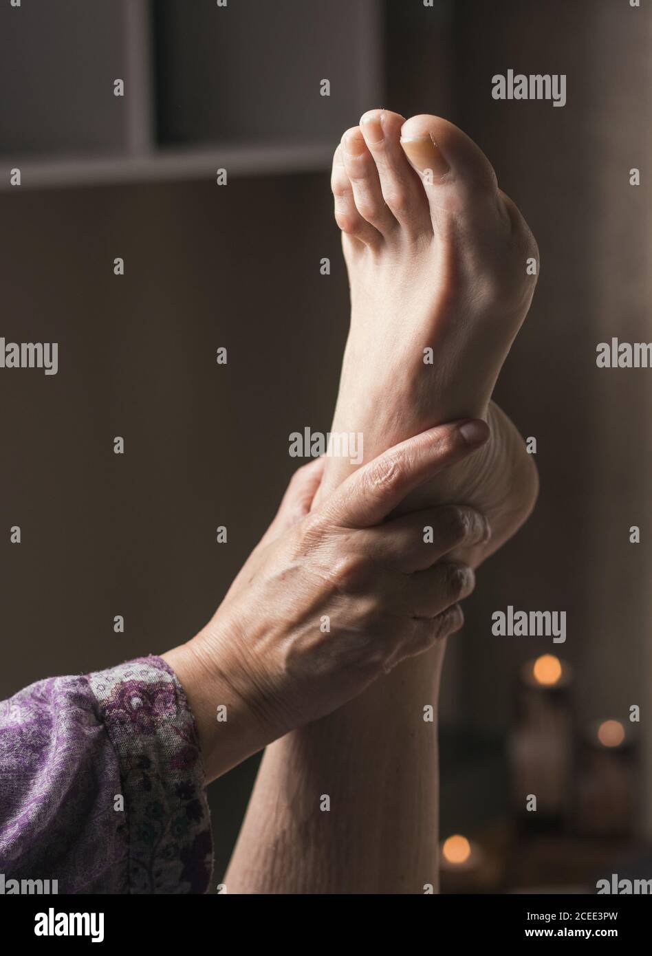 Poor Circulation High Resolution Stock Photography and Images - Alamy