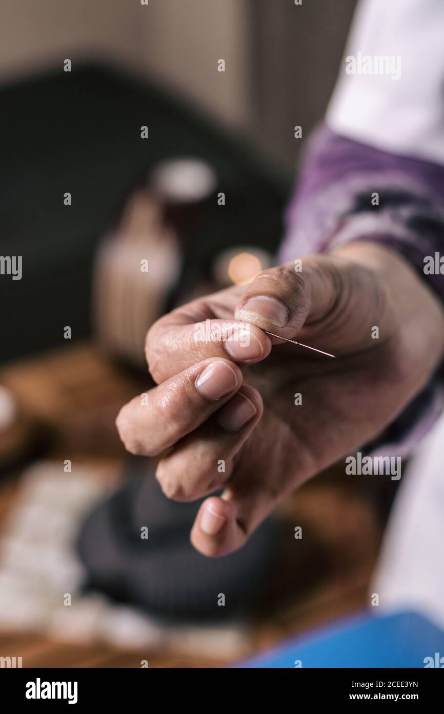 Therapist performing an acupuncture treatment on a patient Woman Stock ...