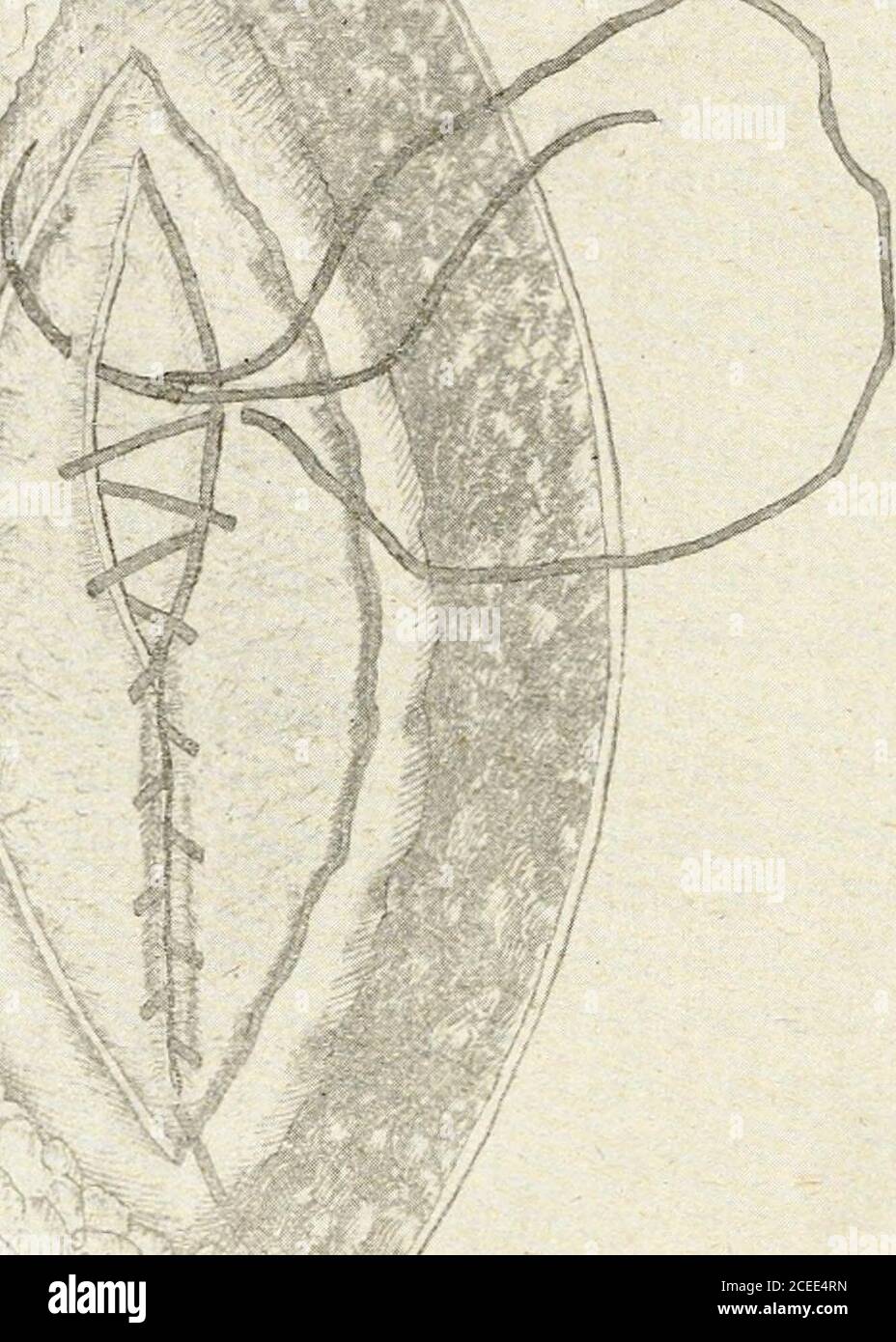 . Plexus. The edges of the peritoneum are caught with forceps, andare ...