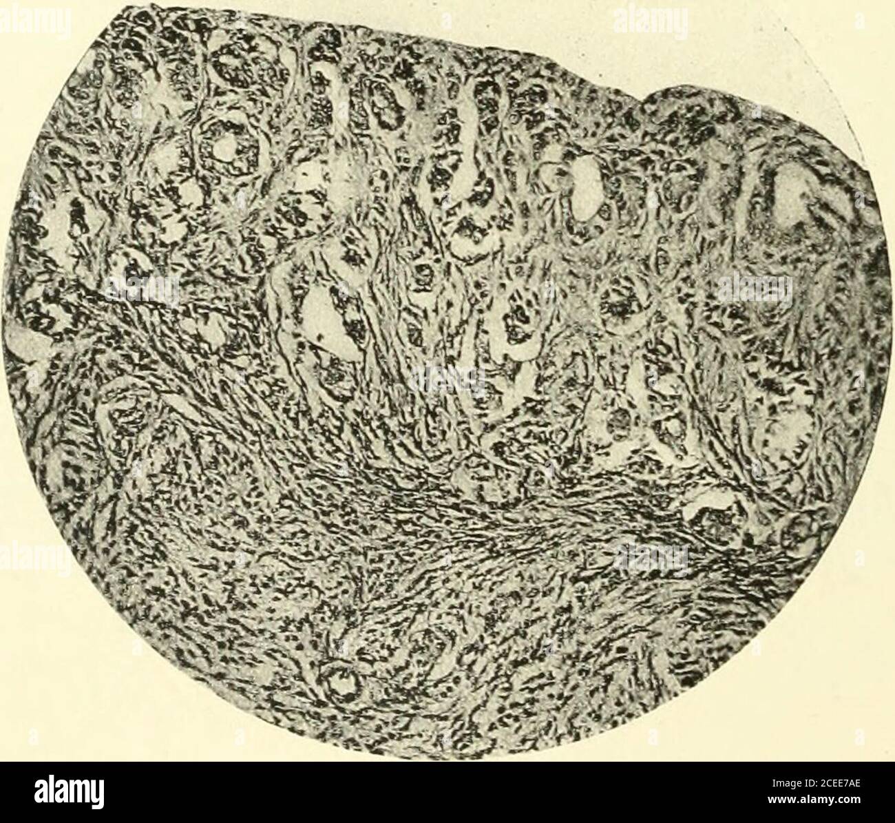 Photomicrograph ovary hi-res stock photography and images - Alamy