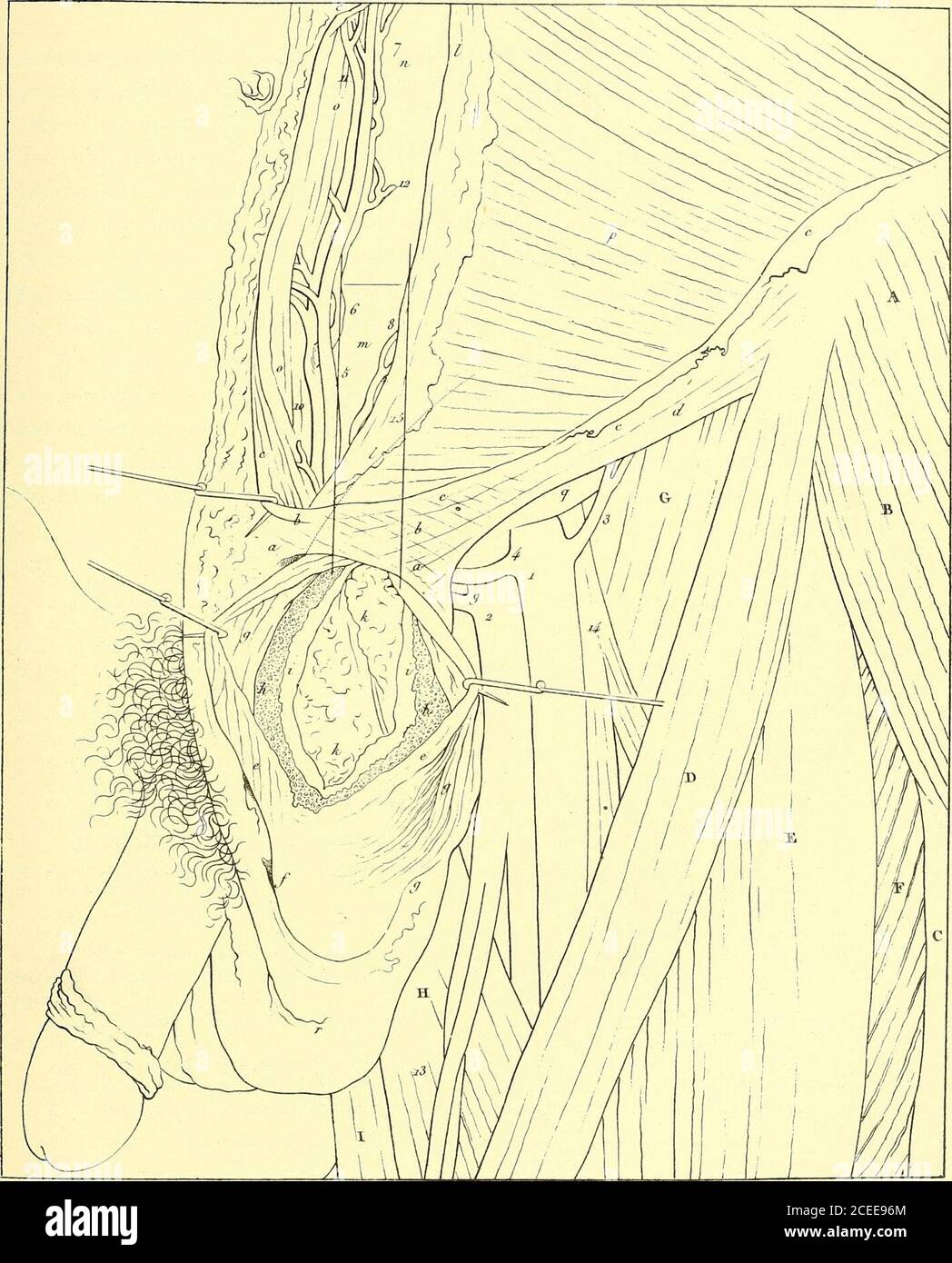 Sheath dr hi-res stock photography and images - Alamy