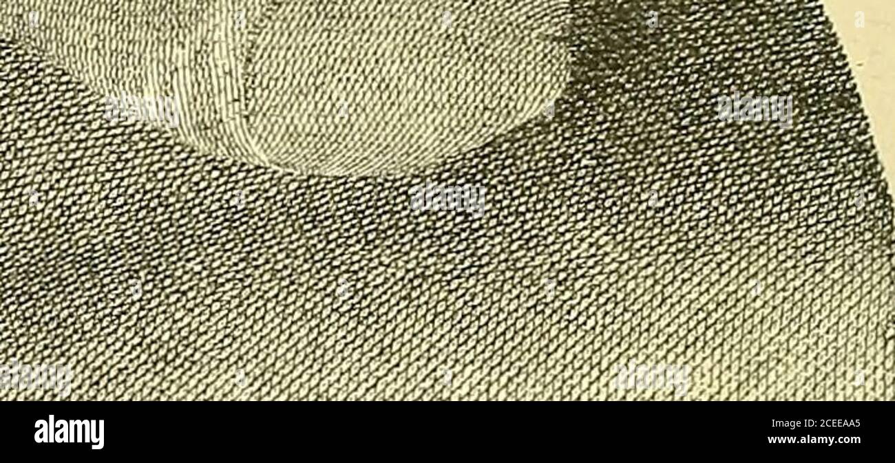 . The anatomy and surgical treatment of hernia. ^^^ STRANGULATED ...