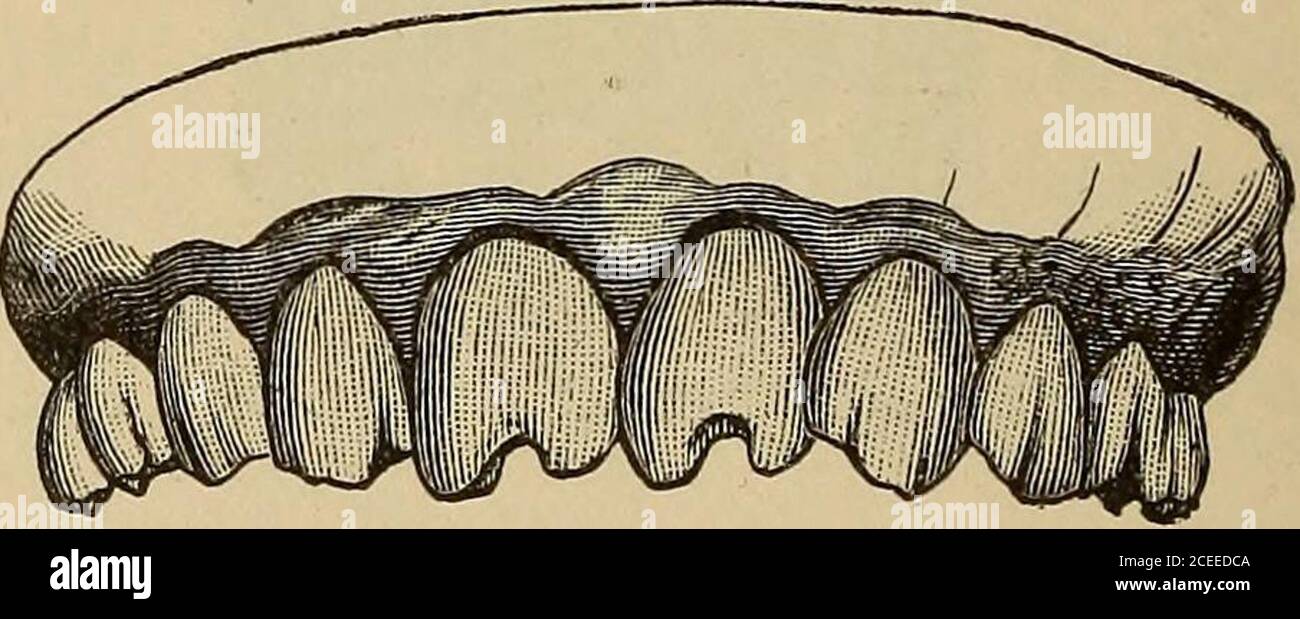Primary syphilis hi-res stock photography and images - Alamy