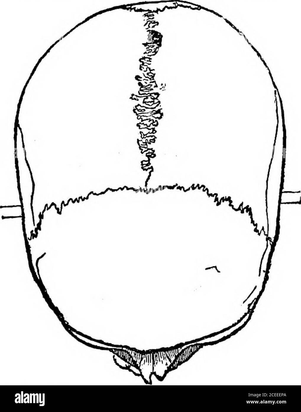 Arches skull arch hi-res stock photography and images - Alamy