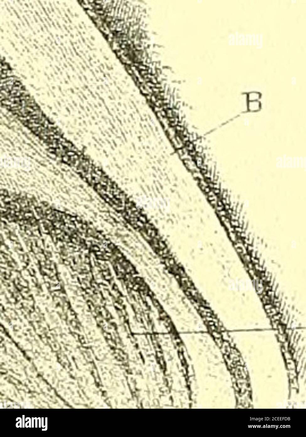 . The anatomy and surgical treatment of hernia. al ring—i. e., the ring ...