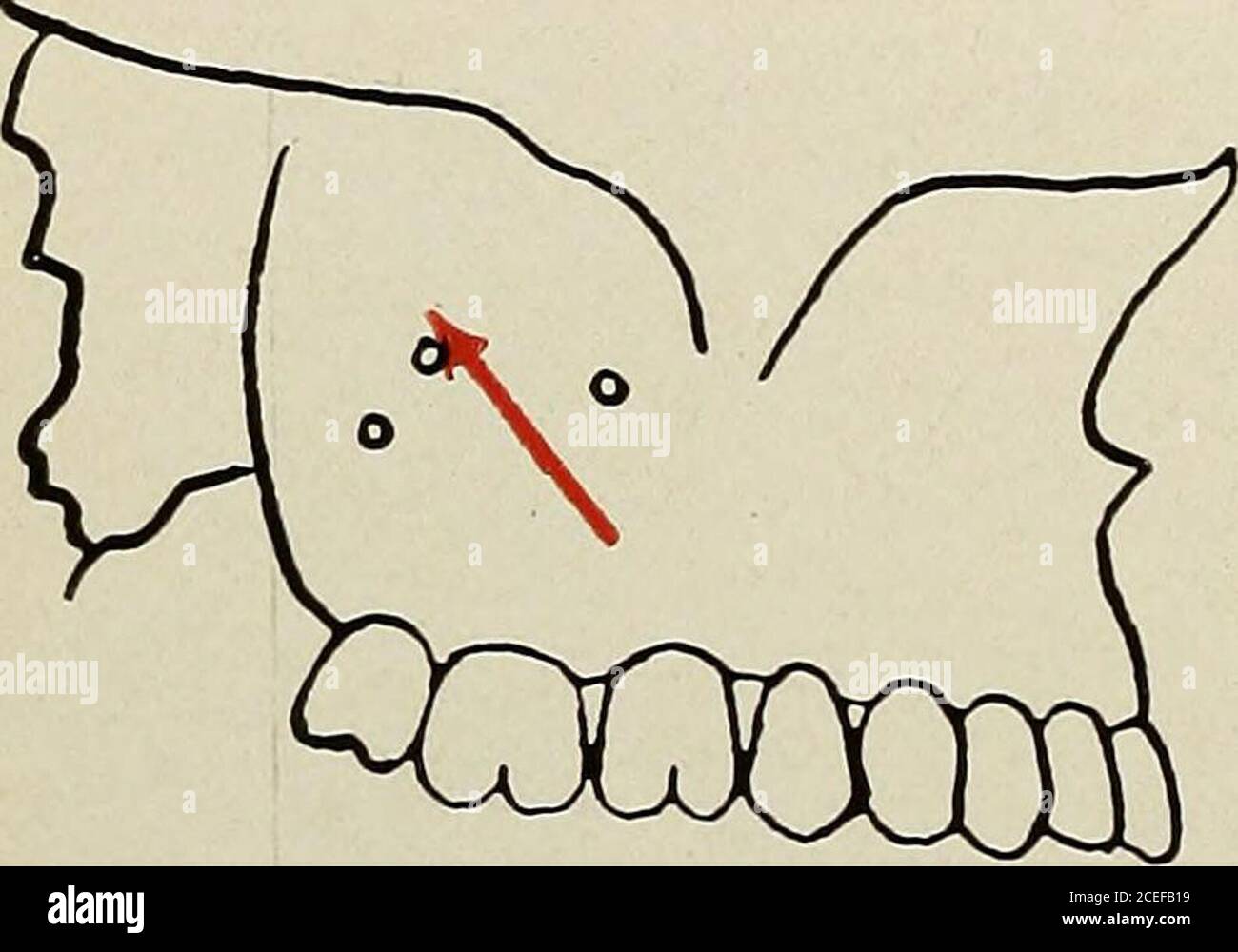 . Oral anaesthesia; local anaesthesia in the oral cavity, technique and ...