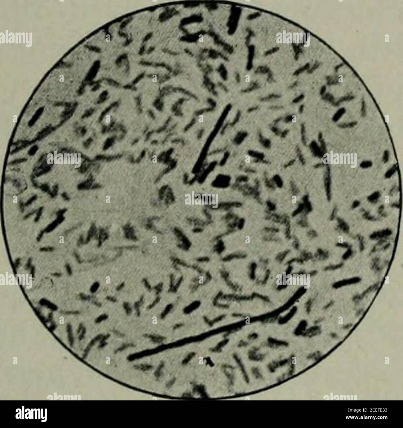 Non staining hi-res stock photography and images - Alamy