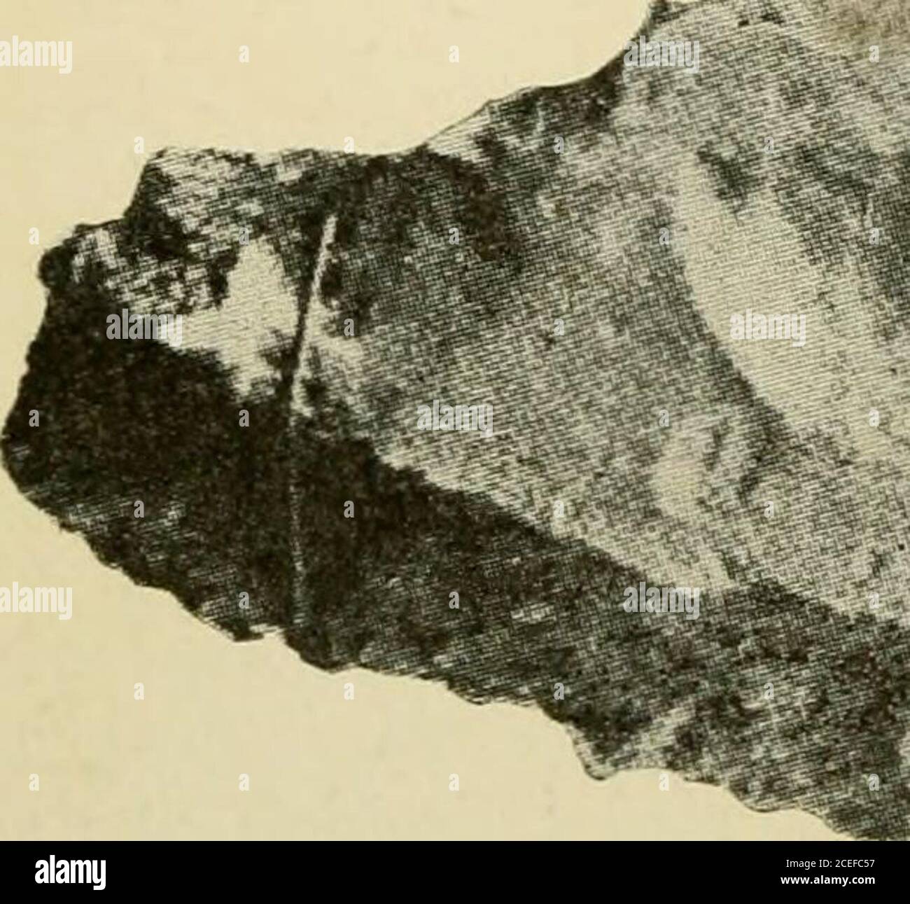 . A new manual of surgery, civil and military. Shell Wound of the Lower ...