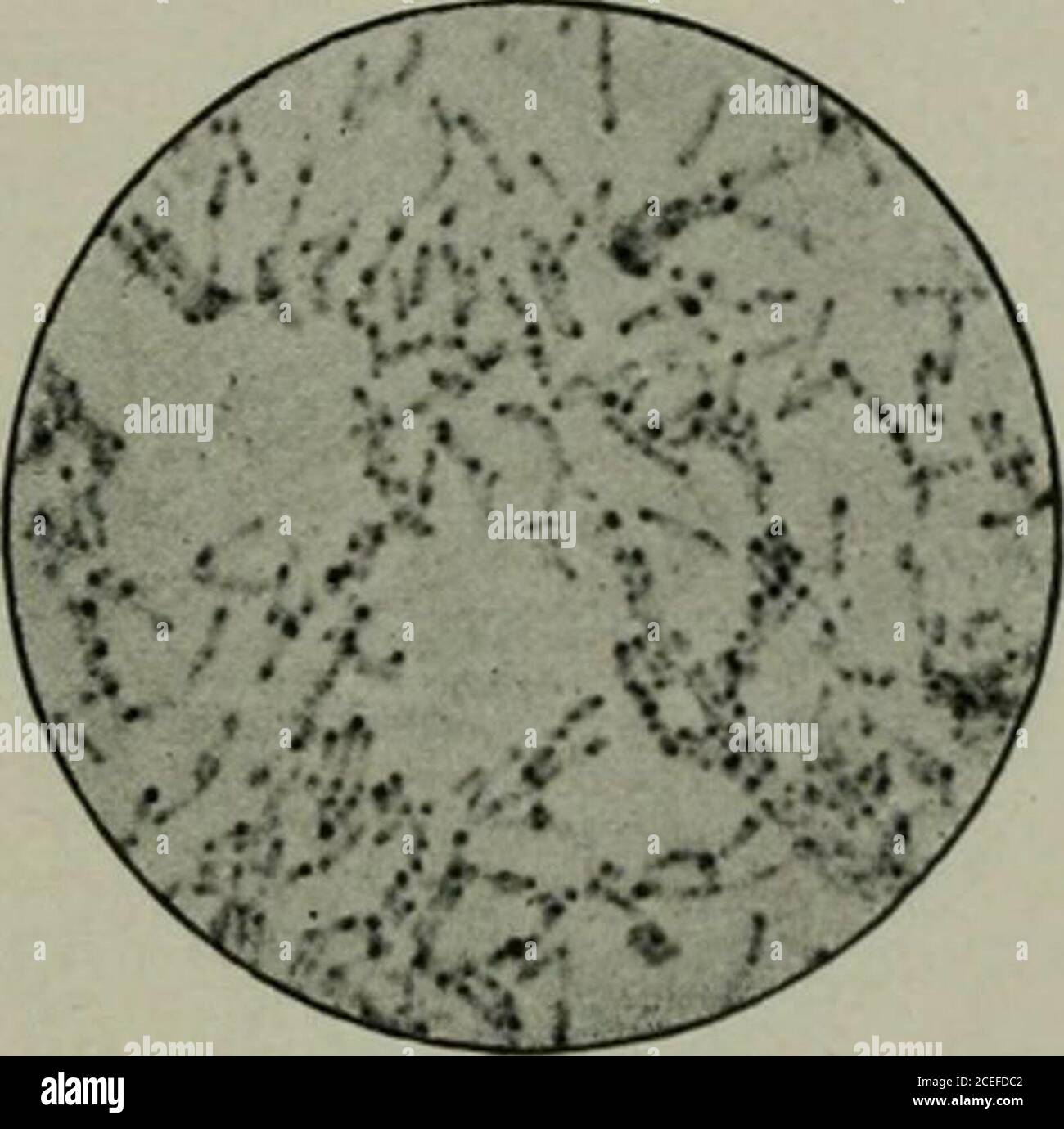 Methylene Blue Stain Bacteria