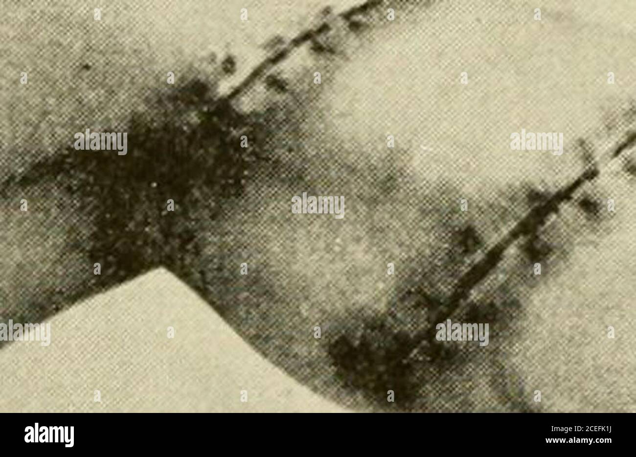 . A new manual of surgery, civil and military. External aspect ...