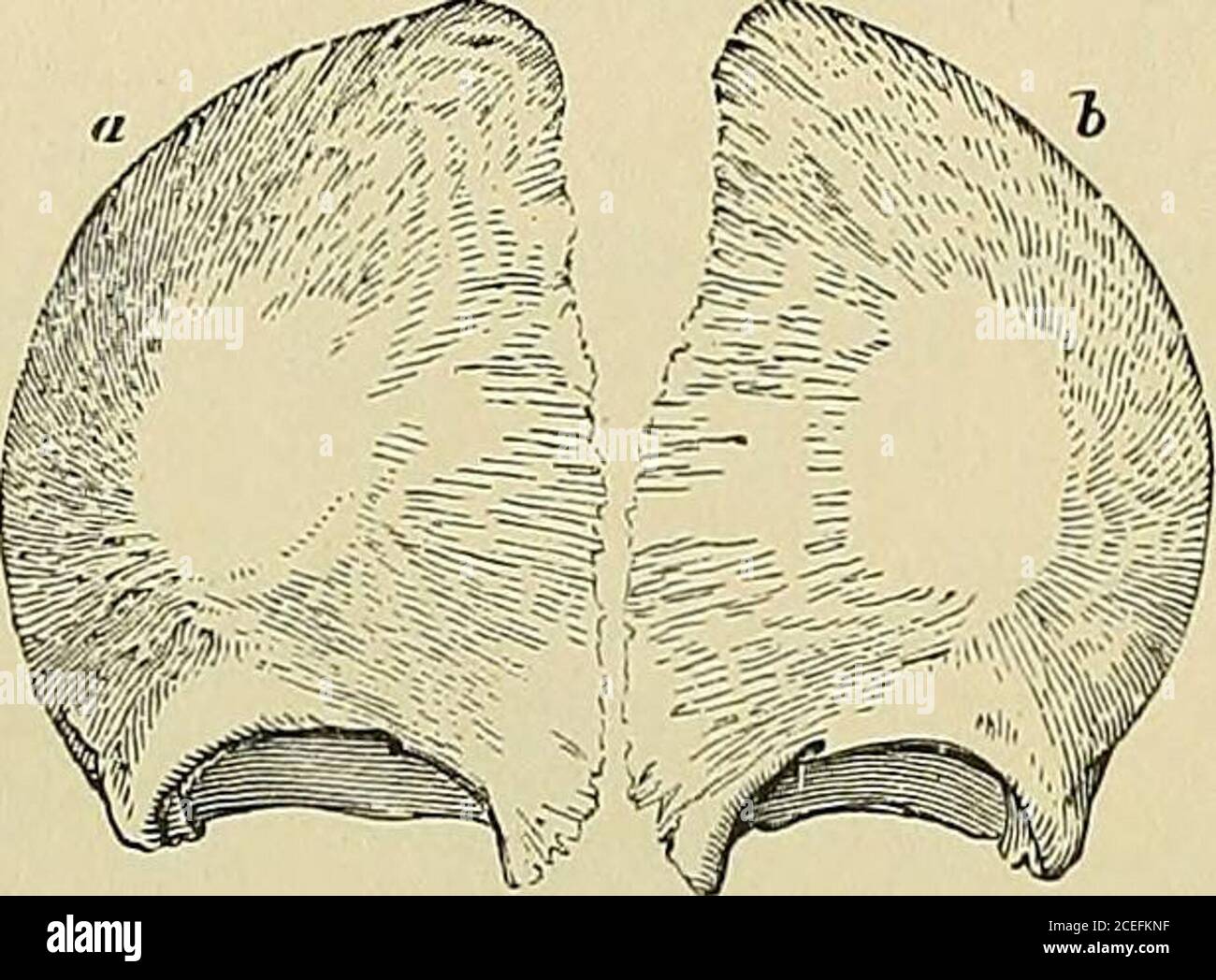 Two parietal bone hi-res stock photography and images - Alamy