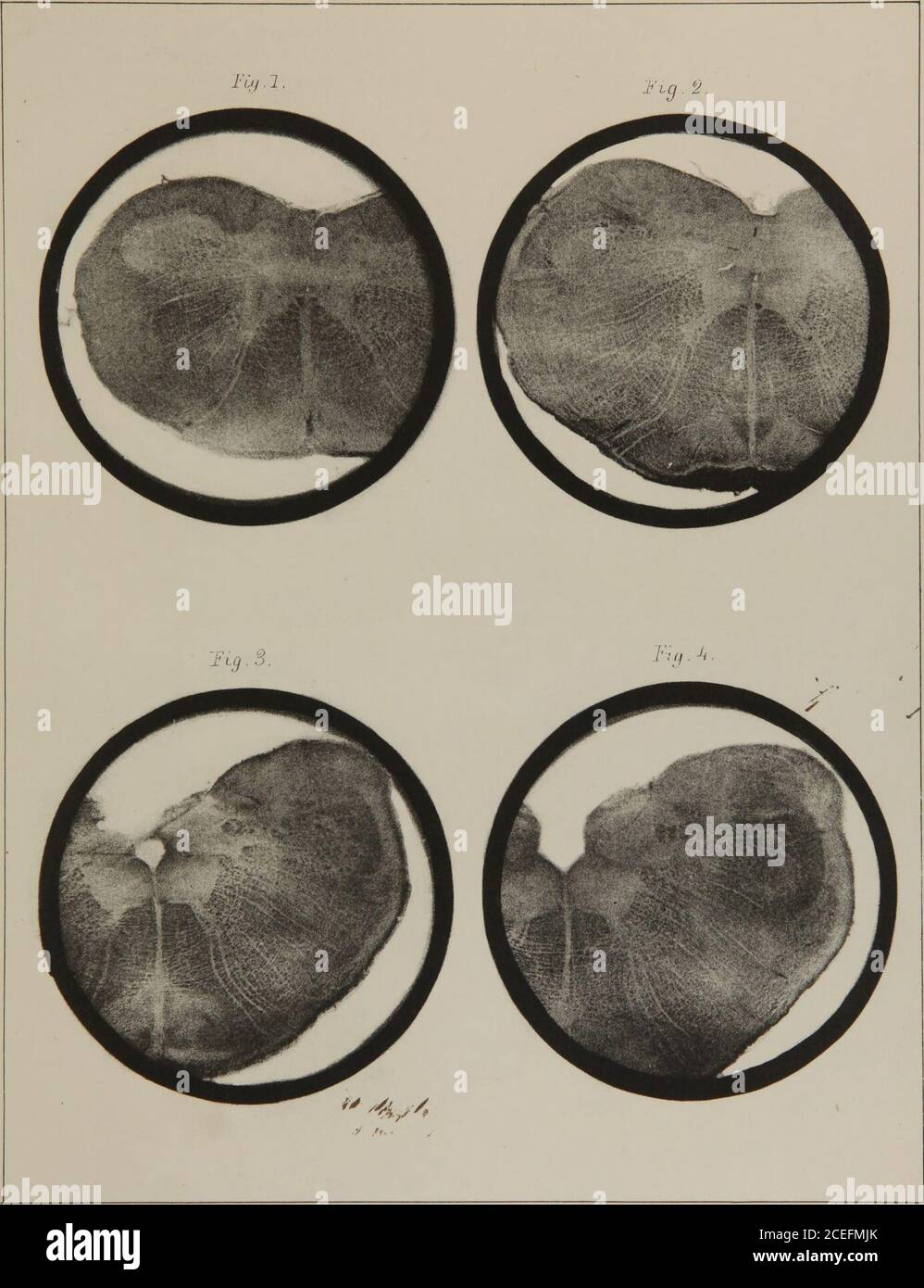 . The gray substance of the medulla oblongata and trapezium ...