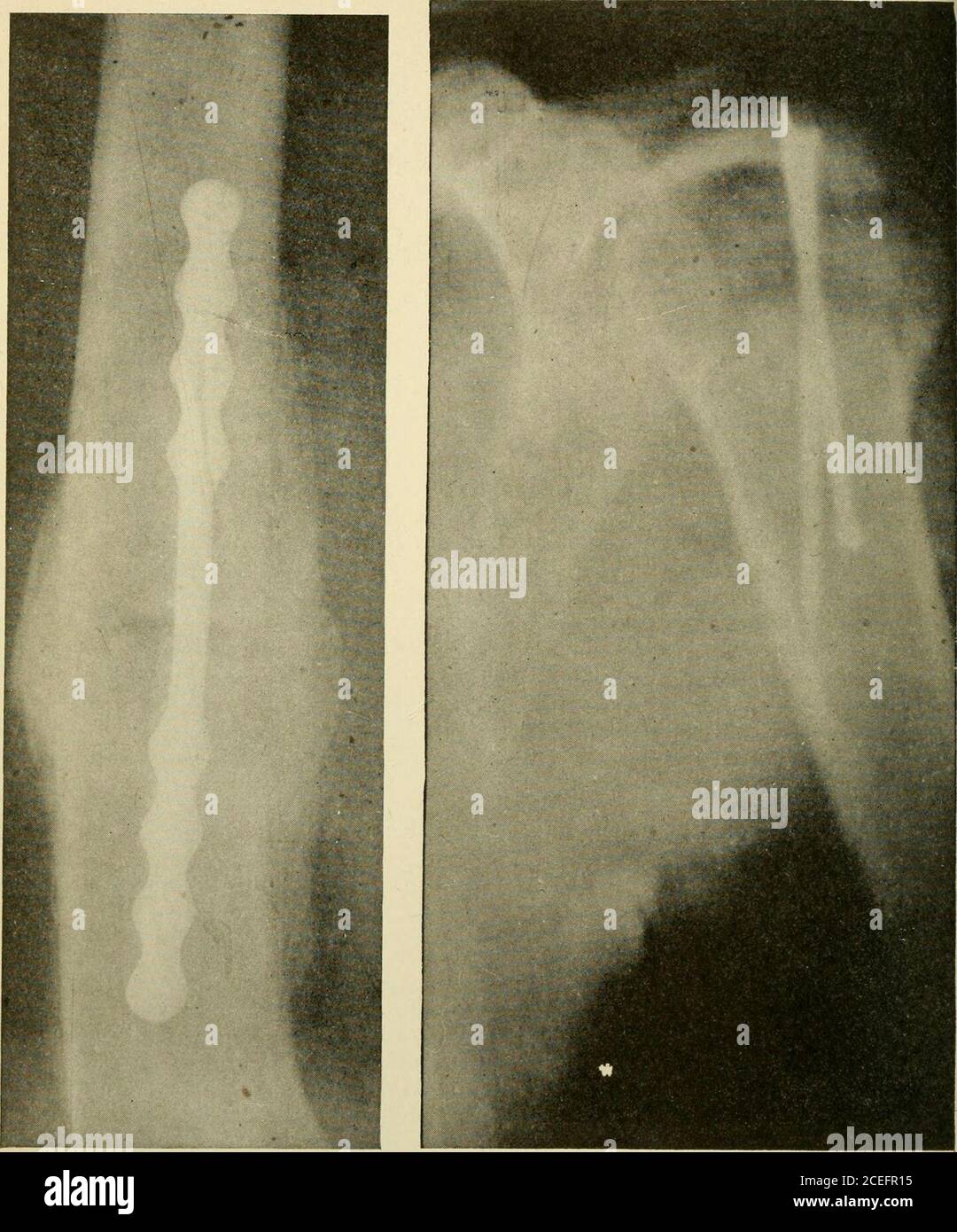 . A new manual of surgery, civil and military. hing to consider is, how ...