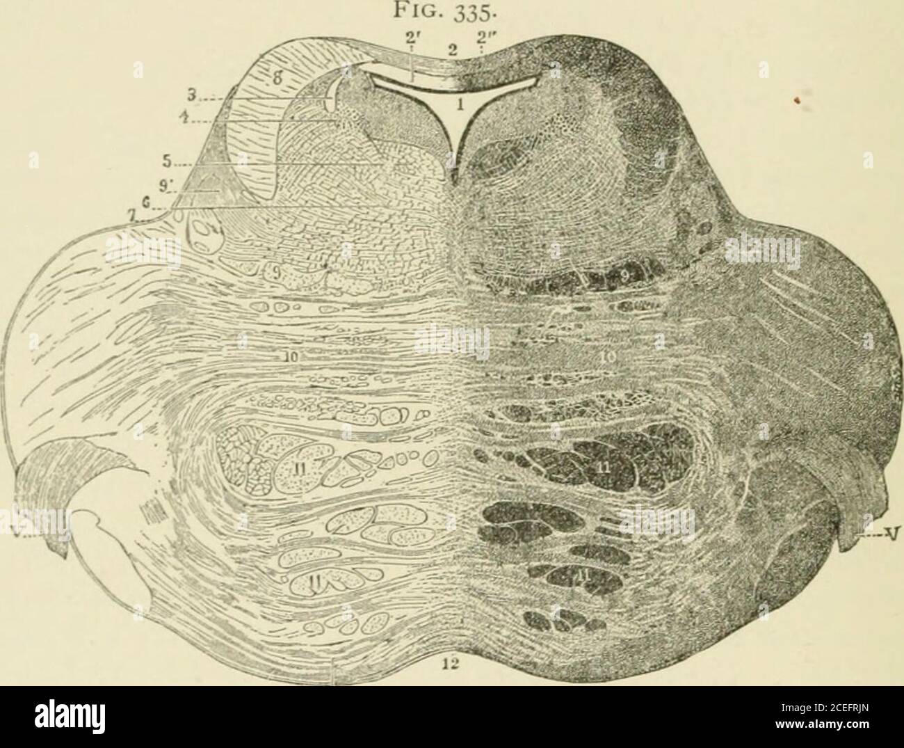 Formatio reticularis hi-res stock photography and images - Alamy