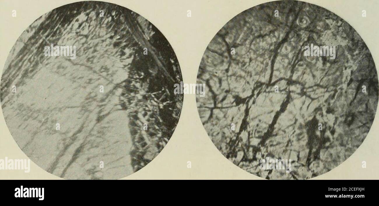 Crossed Nicols High Resolution Stock Photography and Images - Alamy