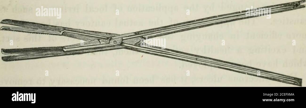 Apex of uvula hi-res stock photography and images - Alamy