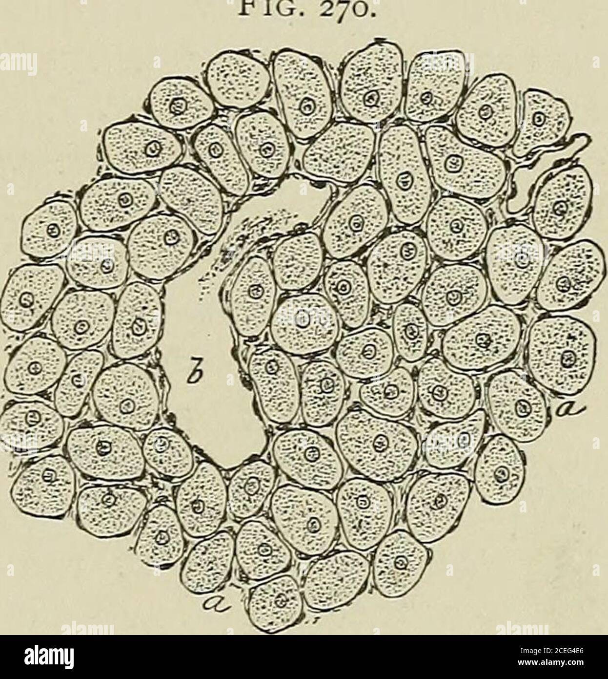 Ruptured follicle hi-res stock photography and images - Alamy
