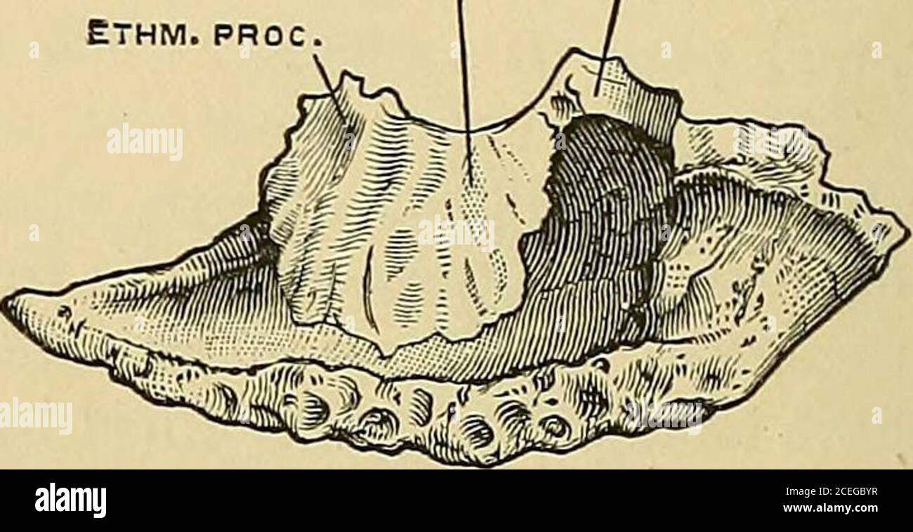 Inferior turbinate bone hi-res stock photography and images - Alamy
