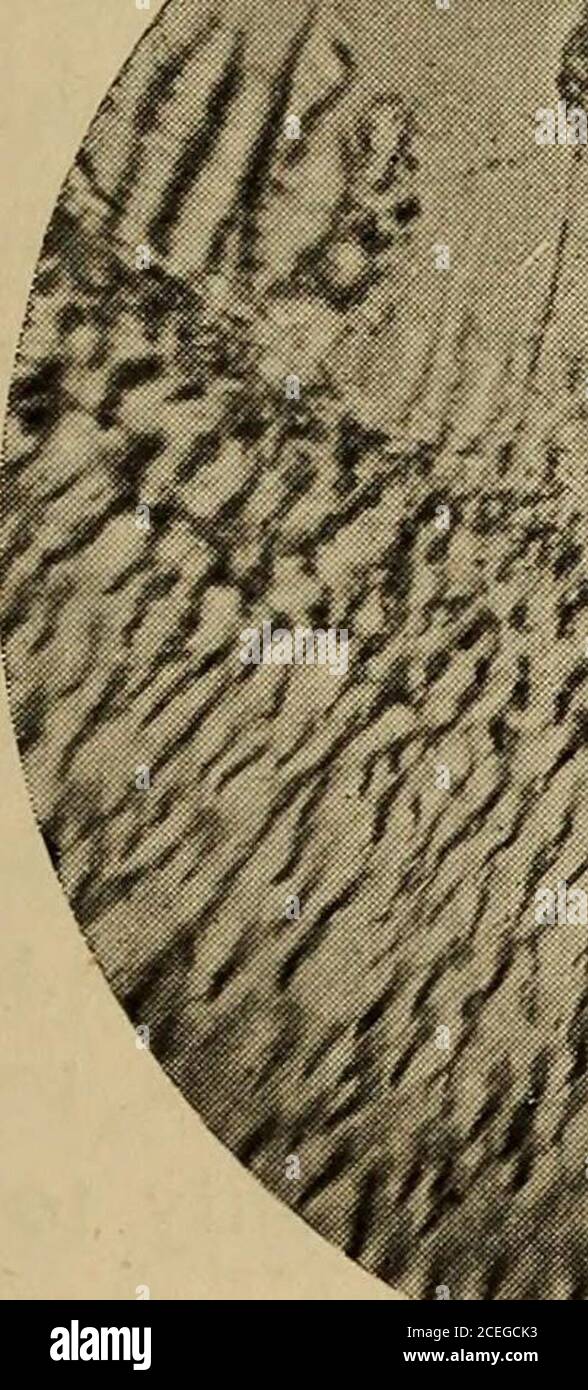 Dentinal Tubules High Resolution Stock Photography and Images - Alamy