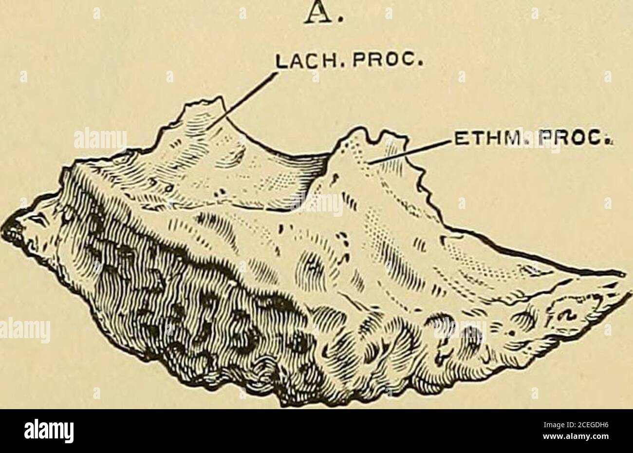 Inferior Turbinate Bone High Resolution Stock Photography and Images ...