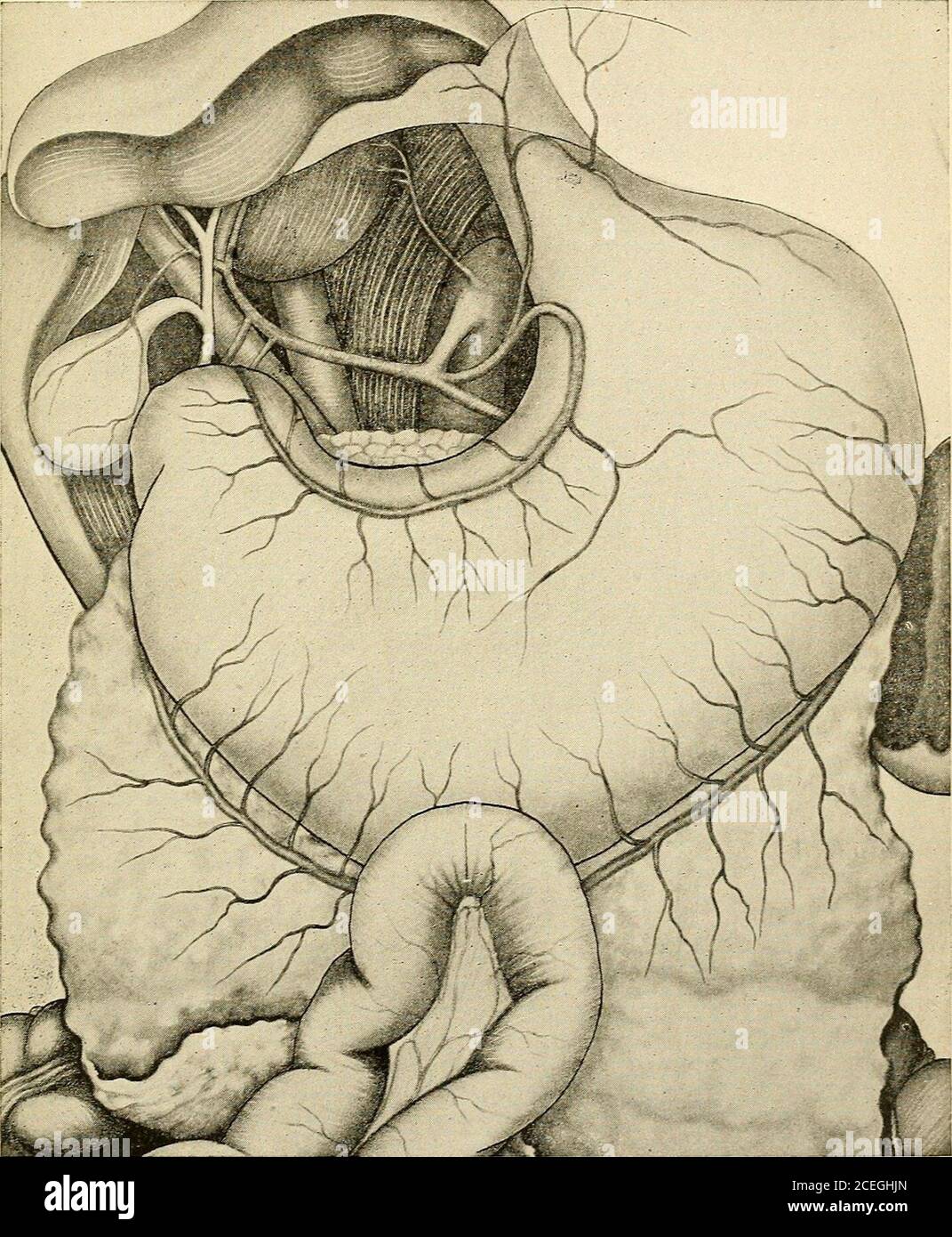 Anastomosis distal hi-res stock photography and images - Alamy