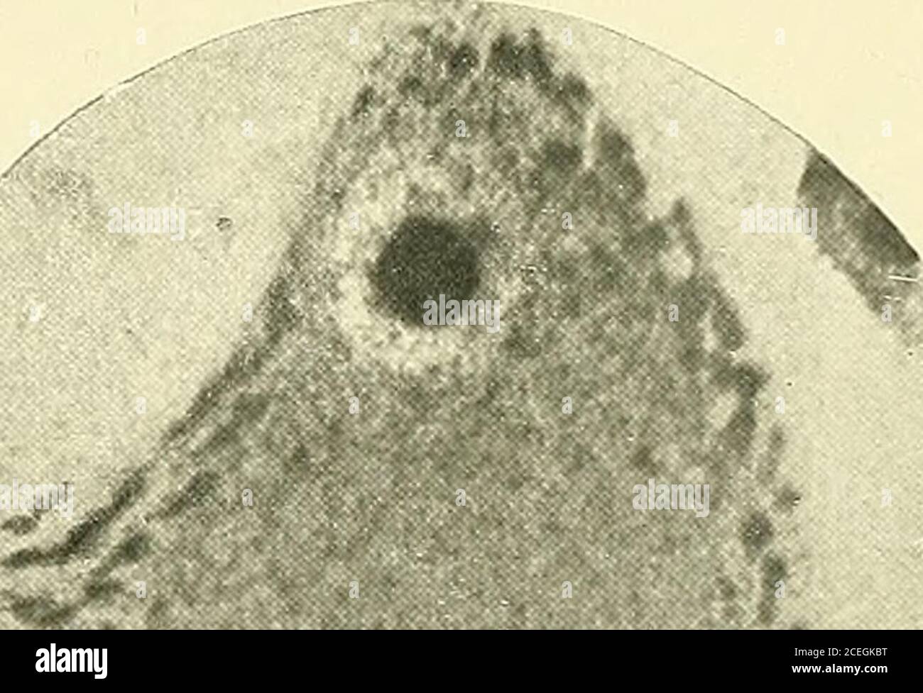 . Epilepsy, a study of the idiopathic disease. ^ittt^ 1U- Fig. 1. xGOO ...
