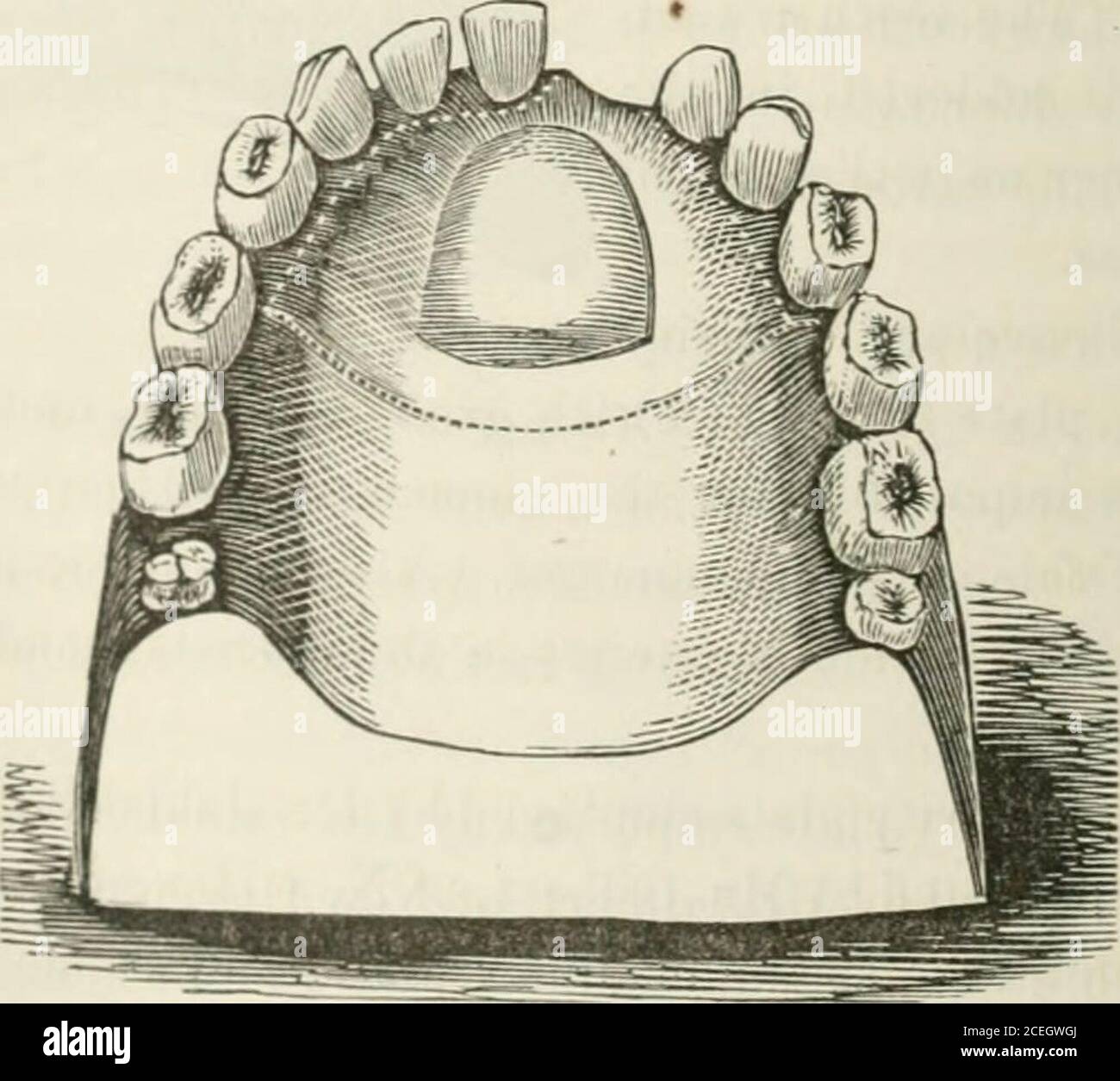 Alveolar ridge hi-res stock photography and images - Alamy