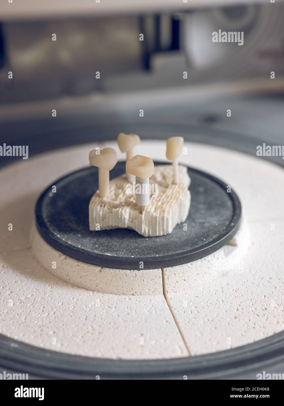 Porcelain teeth hi-res stock photography and images - Alamy