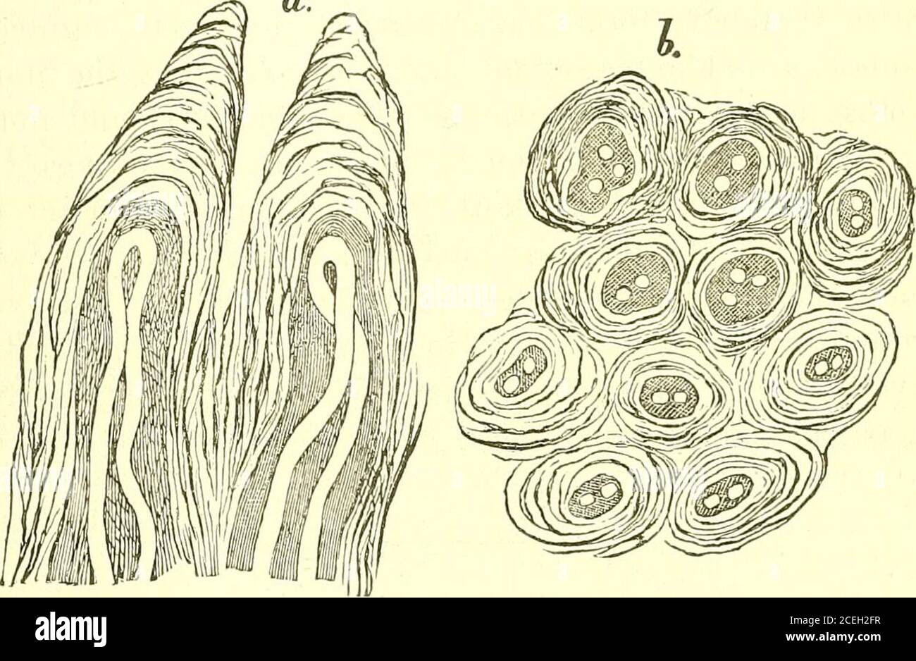 . General surgical pathology and therapeutics, in fifty lectures : a ...