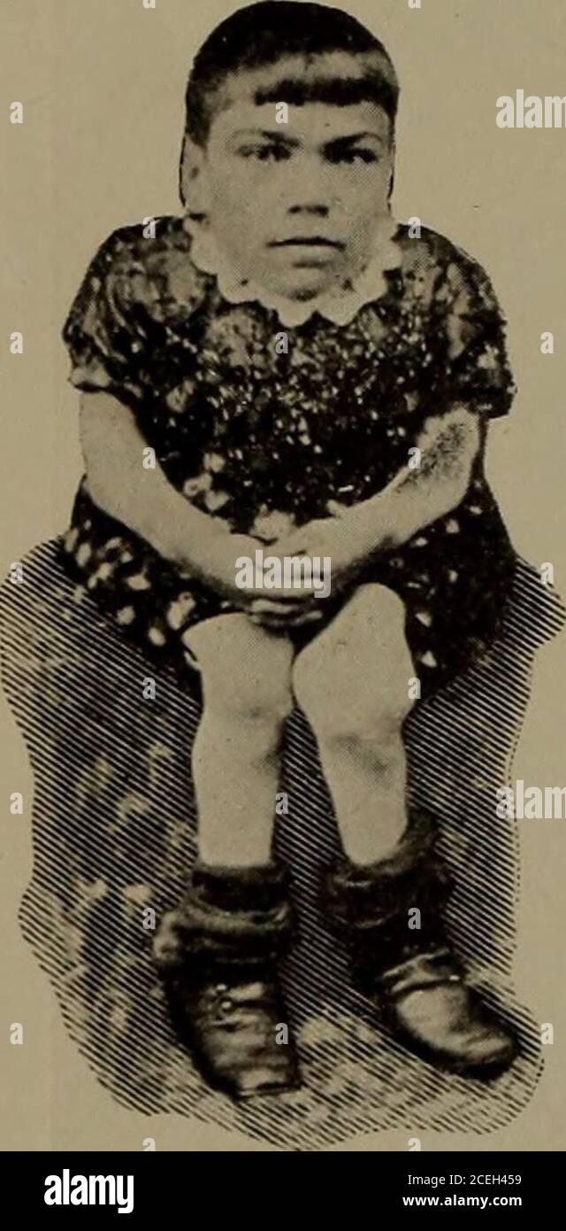 . Medical diseases of infancy and childhood. nital cretinism. 260 ...