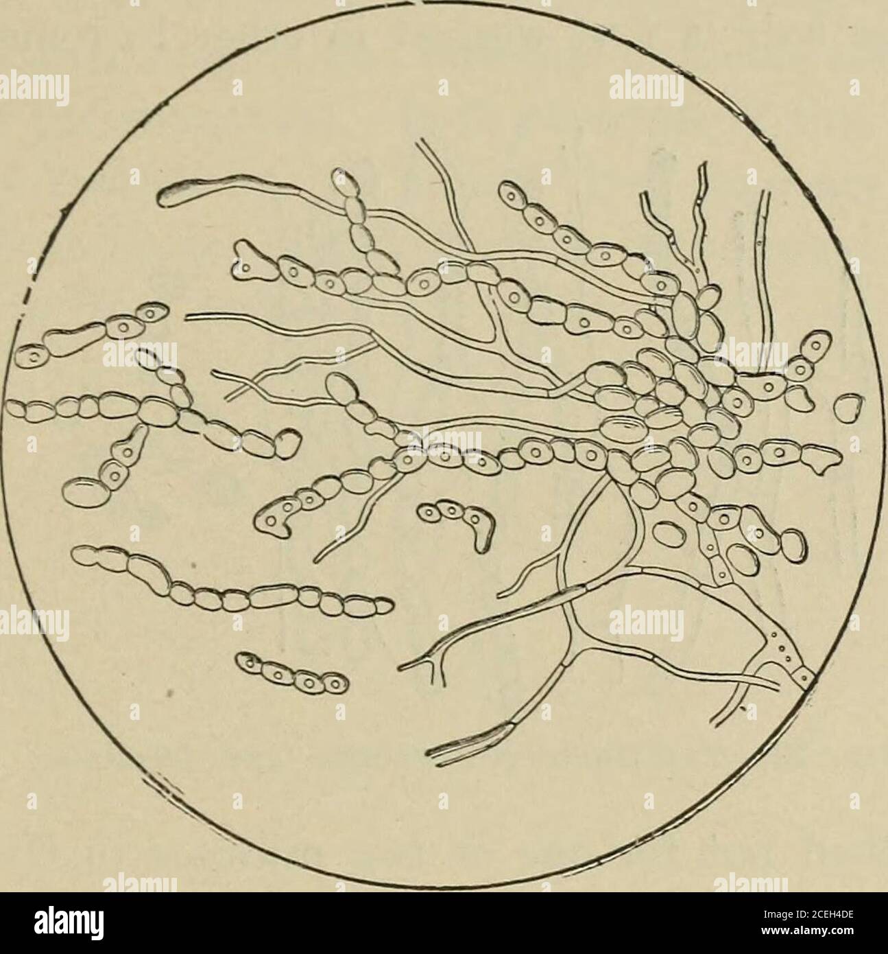 Tinea favosa hi-res stock photography and images - Alamy