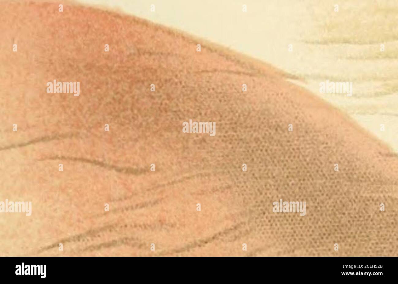 . History and pathology of vaccination. d the appearances depicted in ...