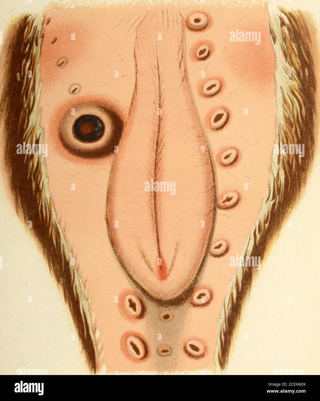. History and pathology of vaccination. r eleva-tion, surrounded with a ...
