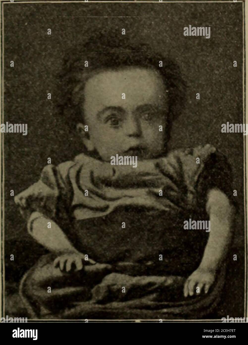 Opisthotonos hi-res stock photography and images - Alamy