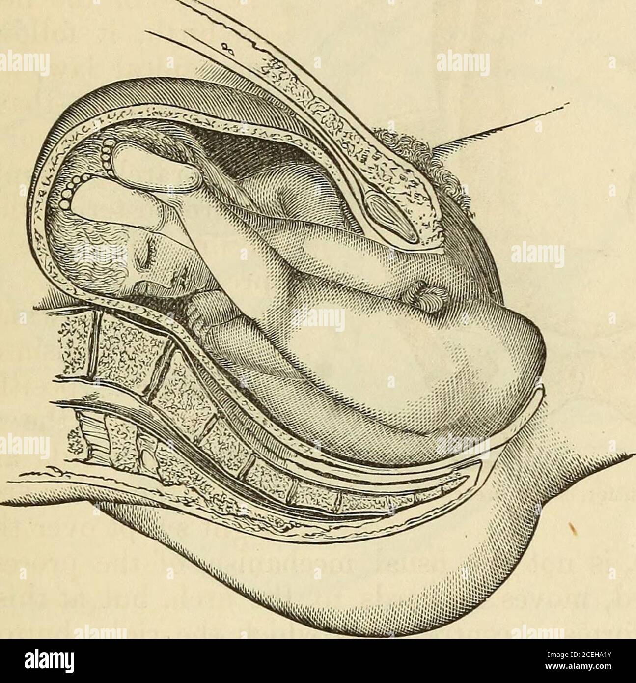 . A system of midwifery, including the diseases of pregnancy and the ...