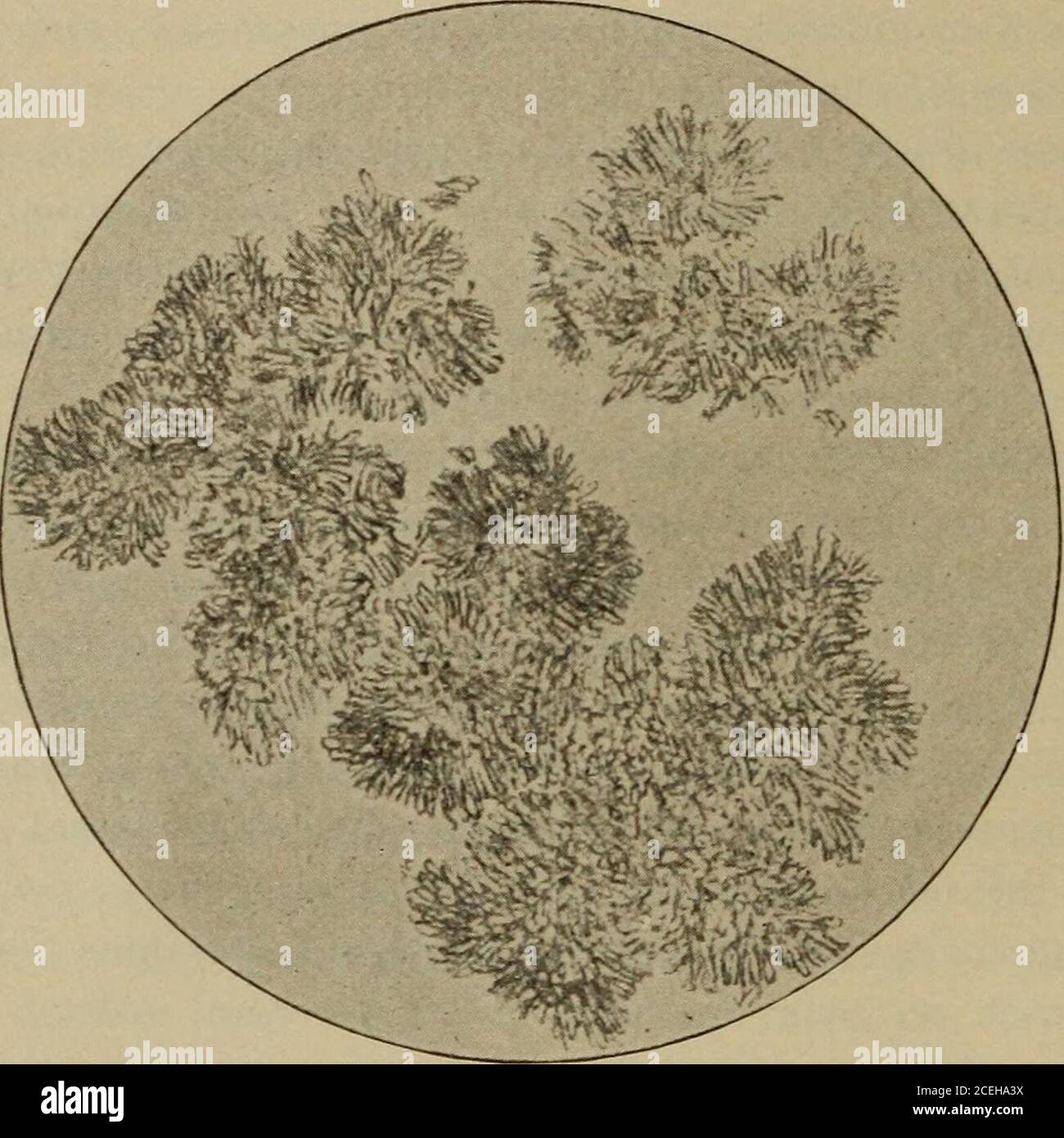 Sputum slide stain hi-res stock photography and images - Alamy