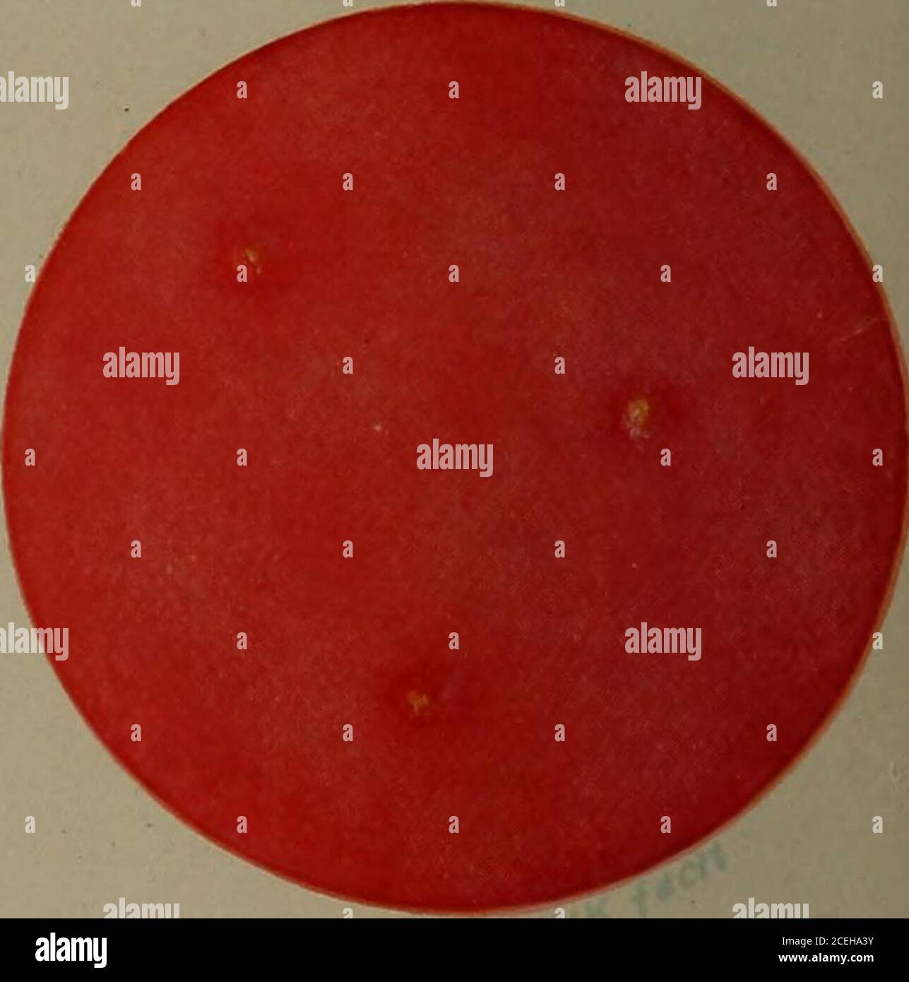 . Medical diseases of infancy and childhood. The Pathognomonic Sign of ...