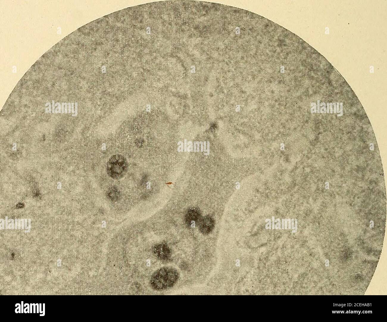 Negri bodies hi-res stock photography and images - Alamy