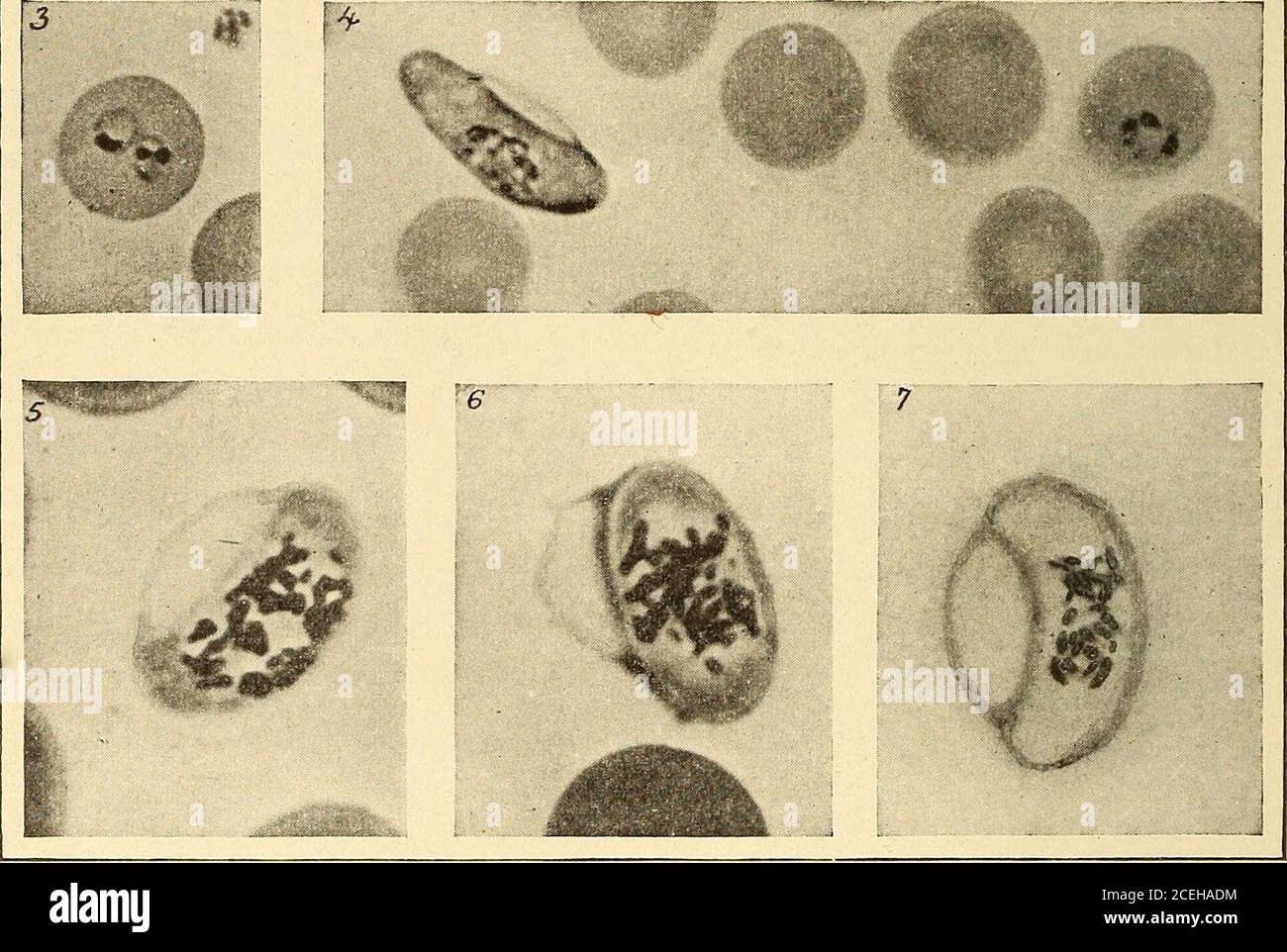 Wright's stain hi-res stock photography and images - Alamy