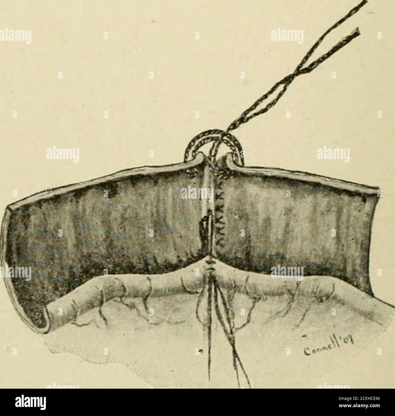 . A new manual of surgery, civil and military. 4. Stitches similar to ...