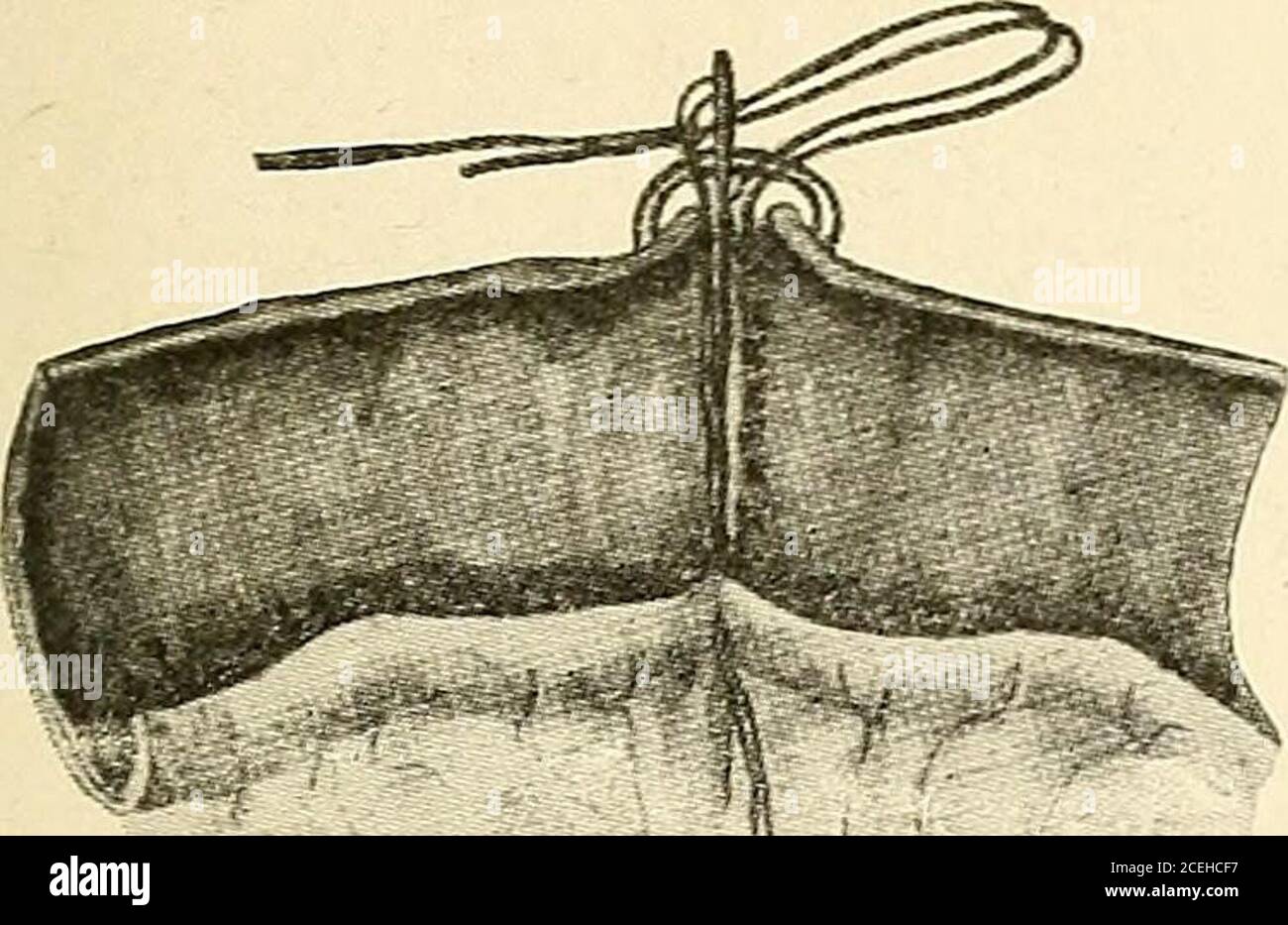 Abdomen Ends High Resolution Stock Photography and Images - Alamy