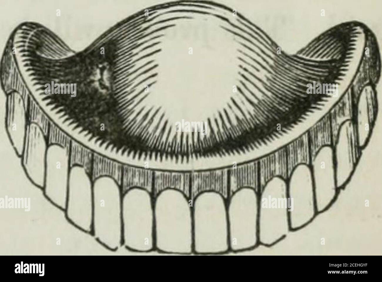 . The principles and practice of dental surgery. V,* of the upper jaw ...