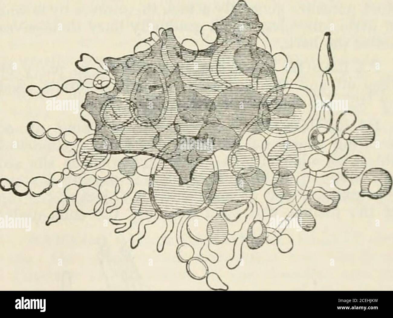 Amputation cause hi-res stock photography and images - Alamy